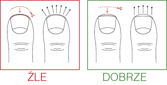 Jak należy obcinać paznokcie u stóp, aby nie wrastały? - Kosmetyki no36